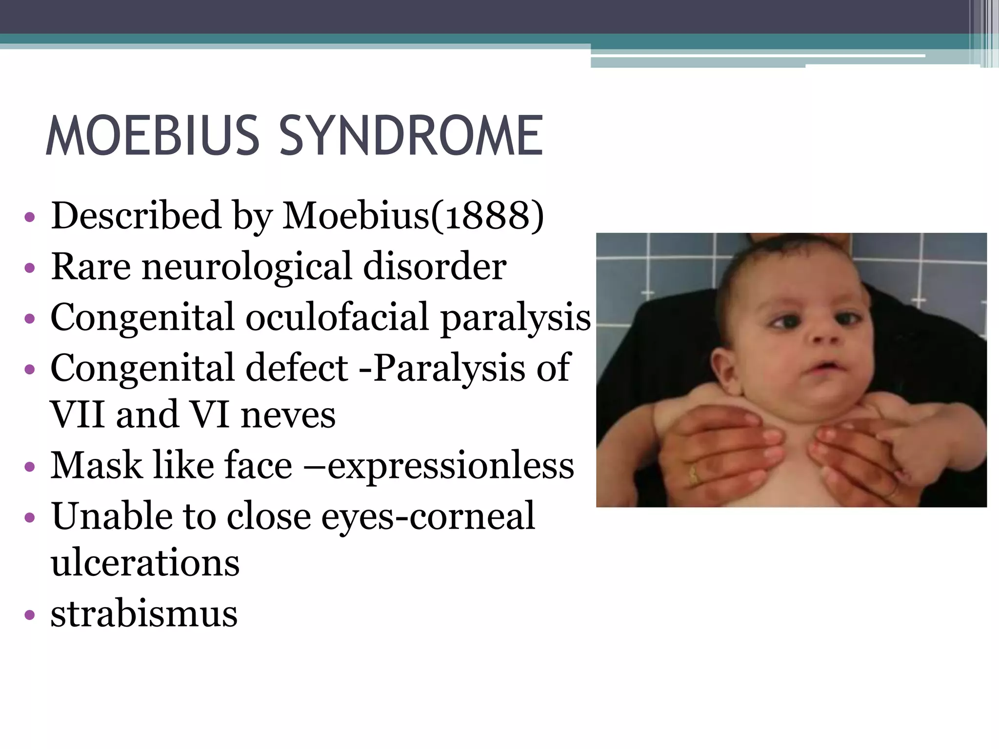 Facial nerve and its disorders | PPTX