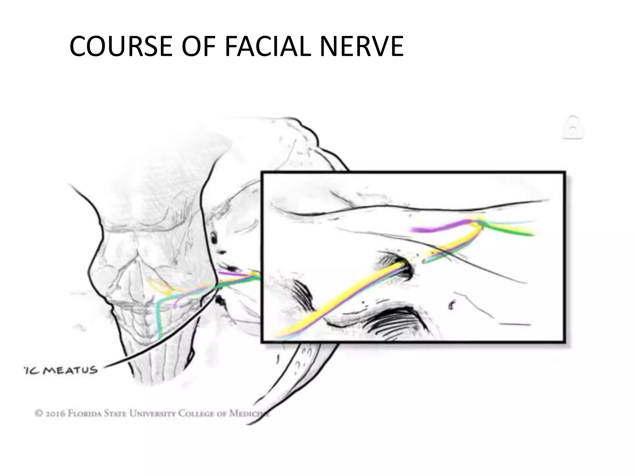 Facial nerve and its disorders | PPTX