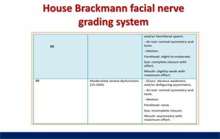 Facial nerve and palsy | PPTX