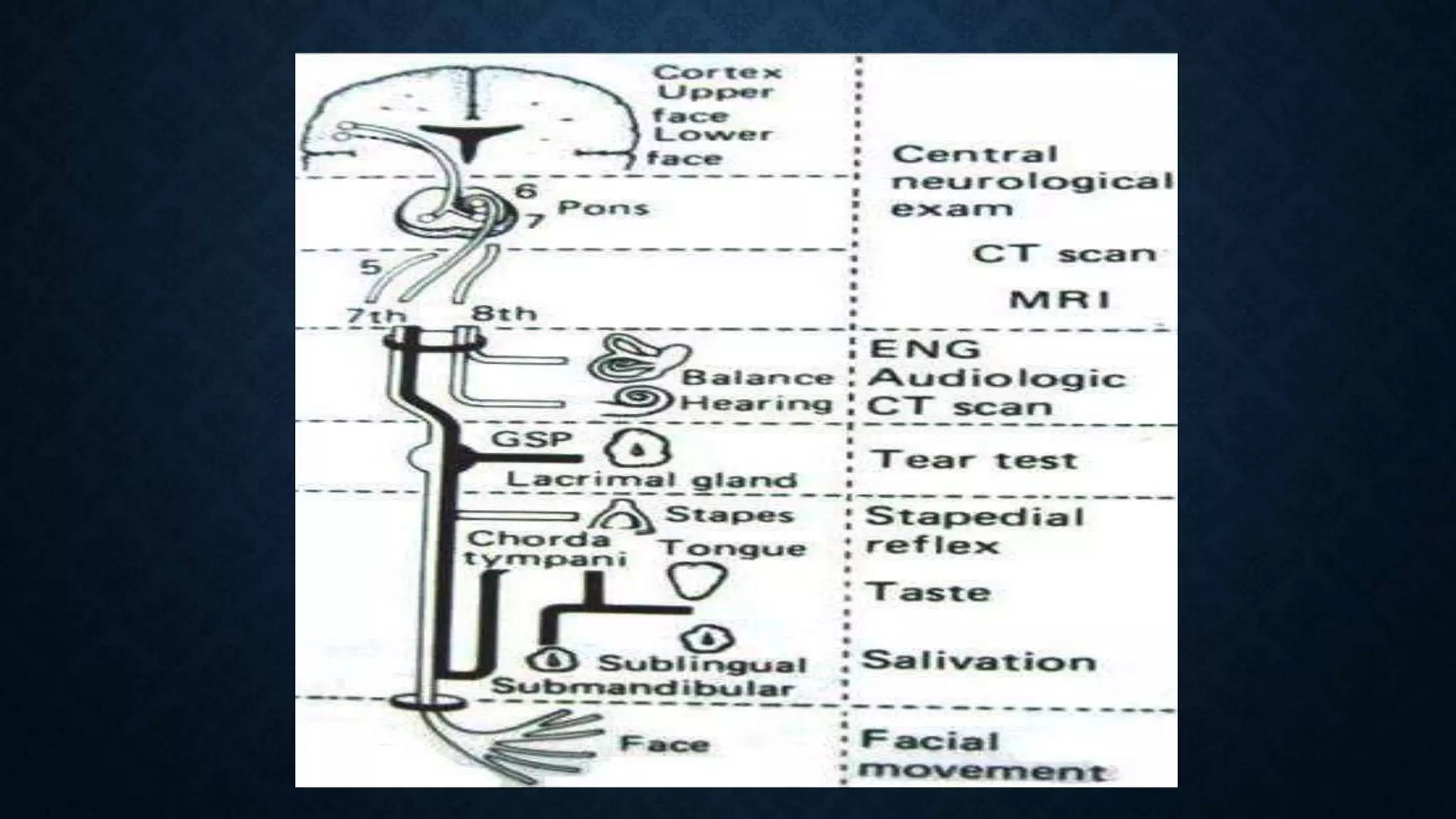 Facial nerve decompression | PPTX