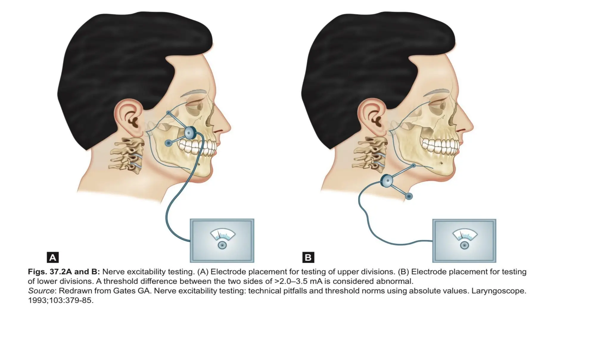 Facial nerve - anatomy, disorders, classifications.pptx