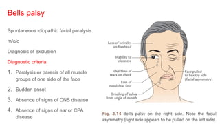 Facial nerve - anatomy, disorders, classifications.pptx
