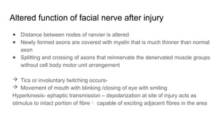 Facial nerve - anatomy, disorders, classifications.pptx