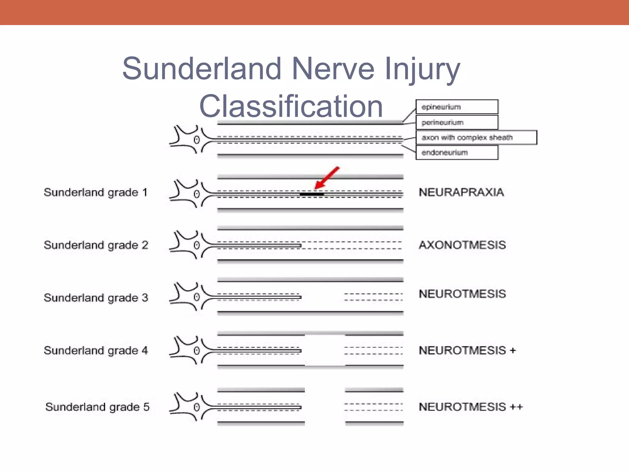 Facial nerve injury | PPT