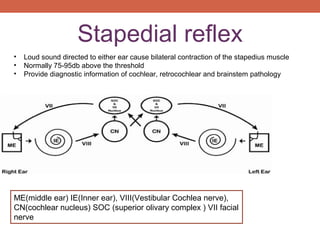 Facial nerve injury | PPT