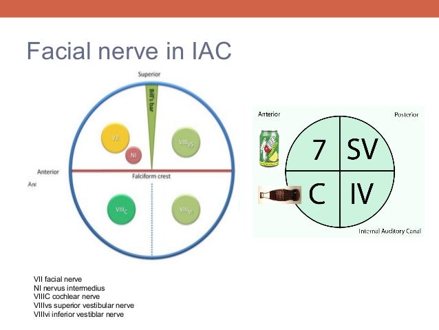 Facial nerve injury