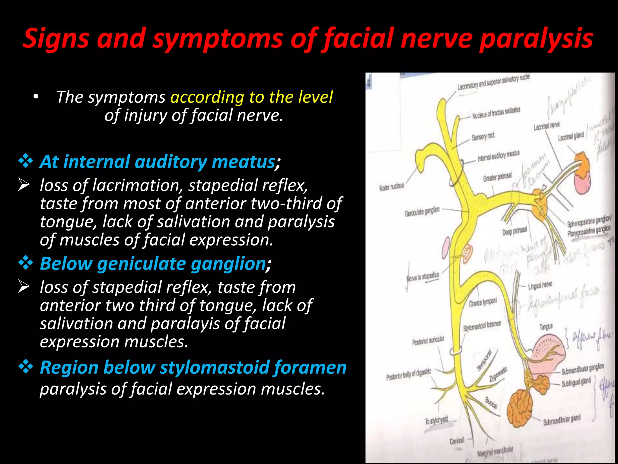Facial nerve injury and reanimation | PPTX
