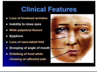 Facial nerve injury and reanimation | PPTX