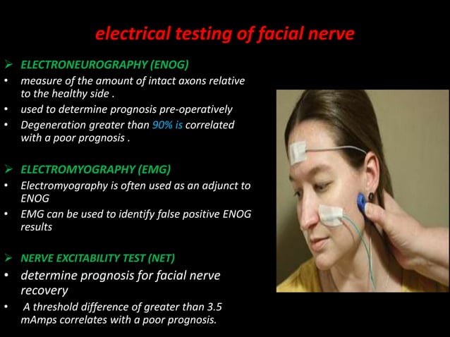 Facial nerve injury and reanimation | PPTX