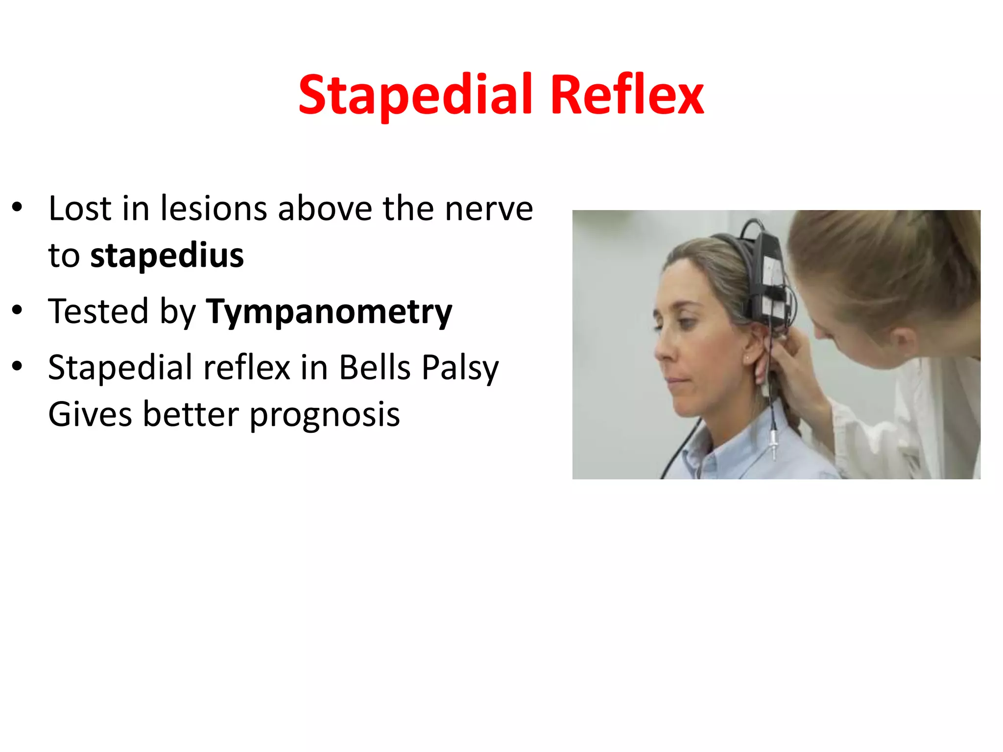Facial Nerve lesions | PPTX
