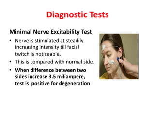 Facial Nerve lesions | PPTX