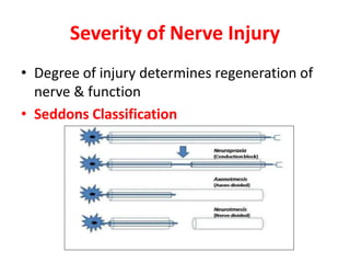 Facial Nerve lesions | PPTX