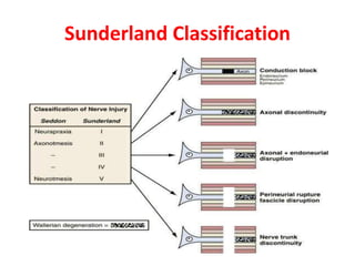 Facial Nerve lesions | PPTX