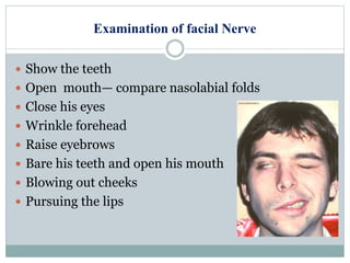 Facial nerve palsy | PPTX