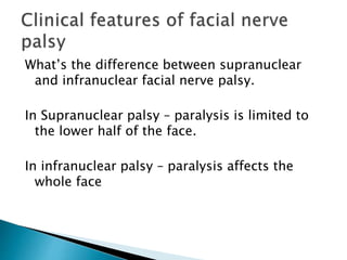 facial_nerve_palsy.ppt