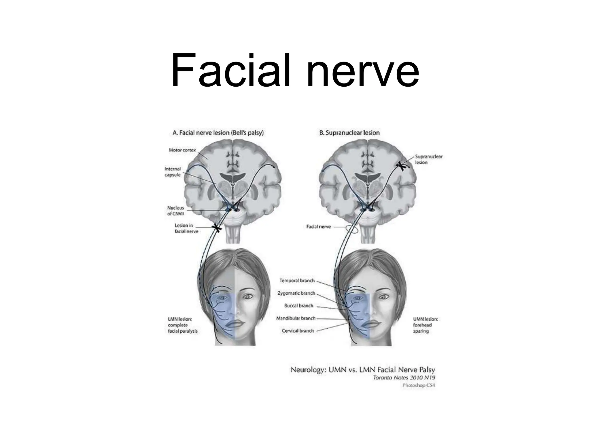 Facial nerve palsy.7th cranial nerve of the system | PPTX