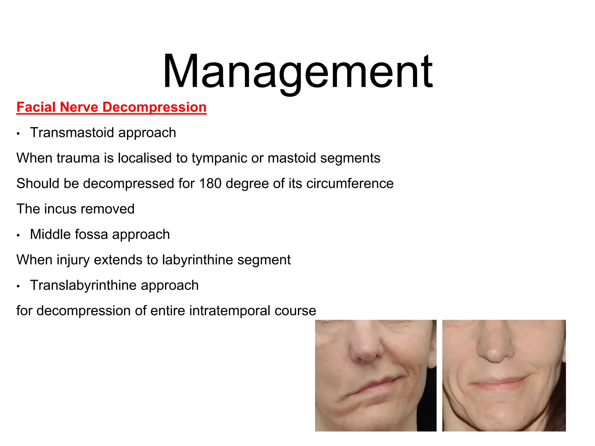 Facial nerve palsy.7th cranial nerve of the system | PPTX