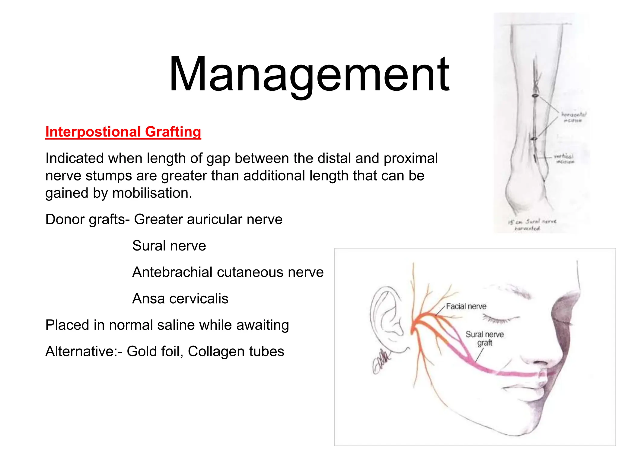 Facial nerve palsy.7th cranial nerve of the system | PPTX