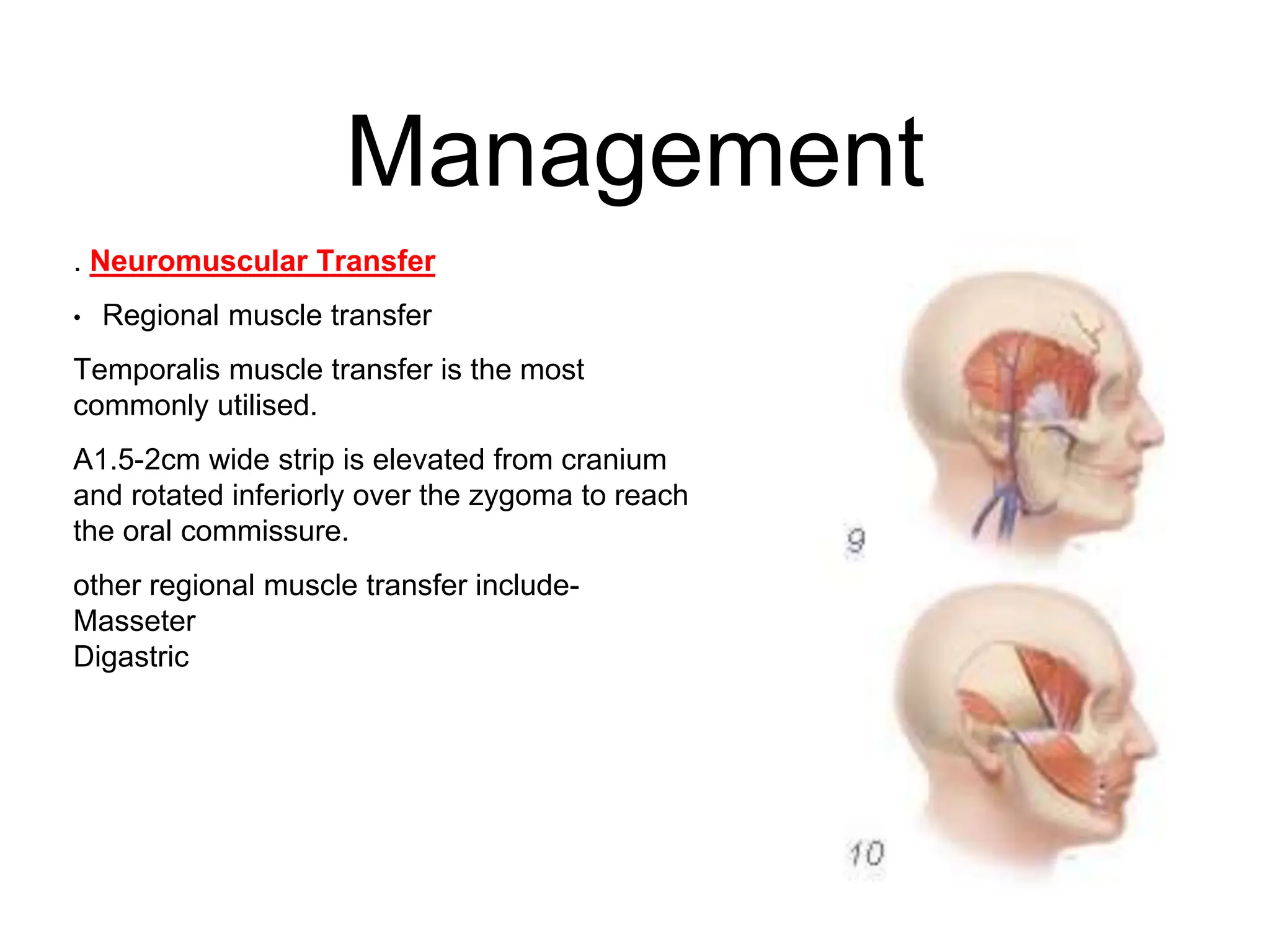 Facial nerve palsy.7th cranial nerve of the system | PPTX