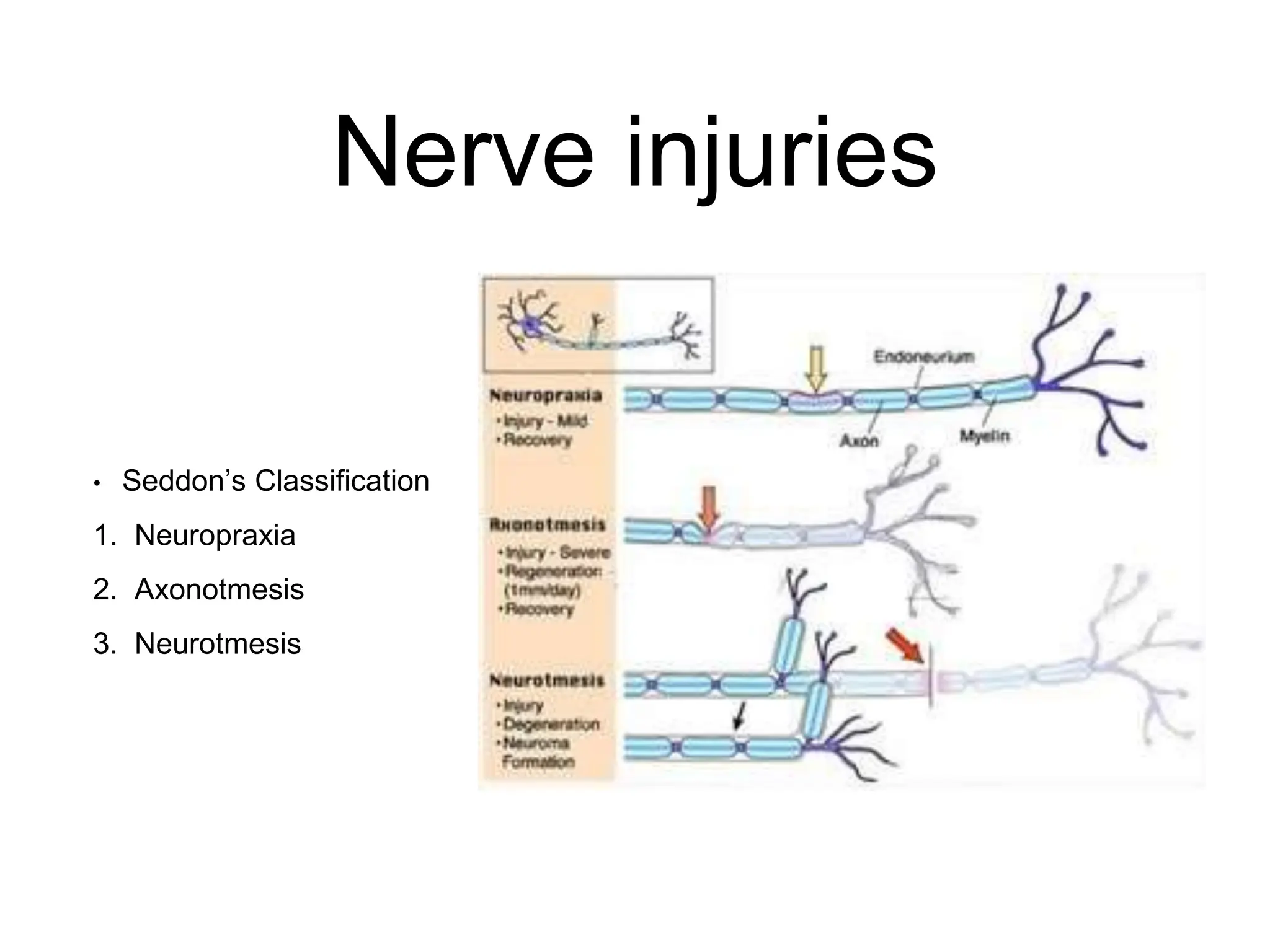 Facial nerve palsy.7th cranial nerve of the system | PPTX