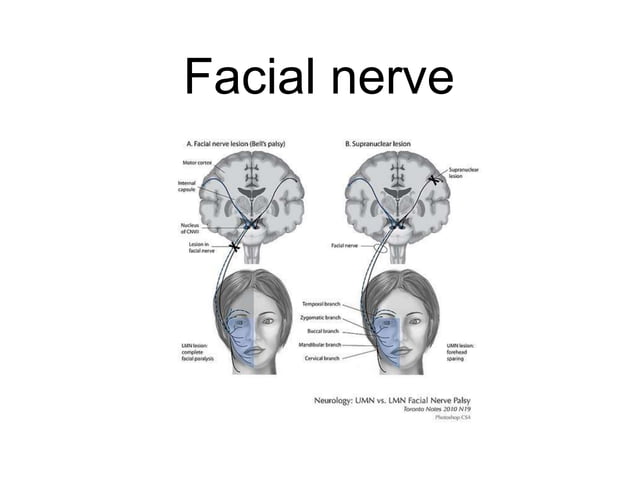 Facial nerve palsy.7th cranial nerve of the system | PPTX | Death ...