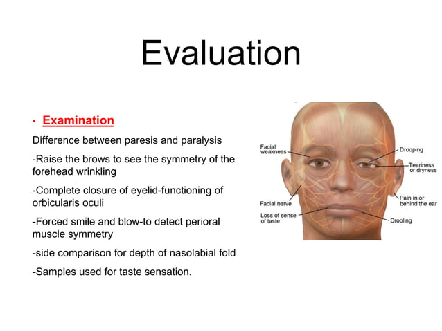 Facial nerve palsy.7th cranial nerve of the system | PPTX | Death ...