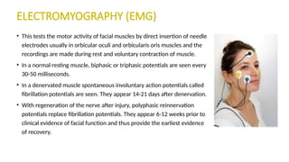 Facial Nerve Anatomy, Diseases And its Management | PPTX
