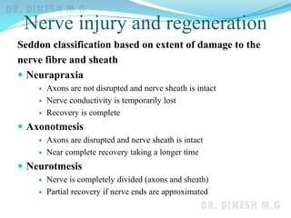 Facial nerve palsy & Trigeminal neuralgia | PDF