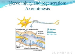 Facial nerve palsy & Trigeminal neuralgia | PDF