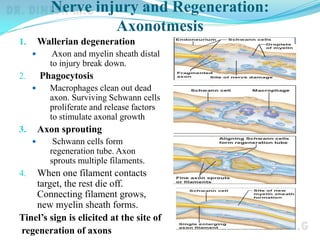 Facial nerve palsy & Trigeminal neuralgia | PDF