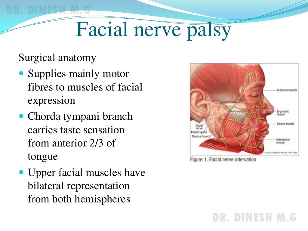 Facial nerve palsy & Trigeminal neuralgia