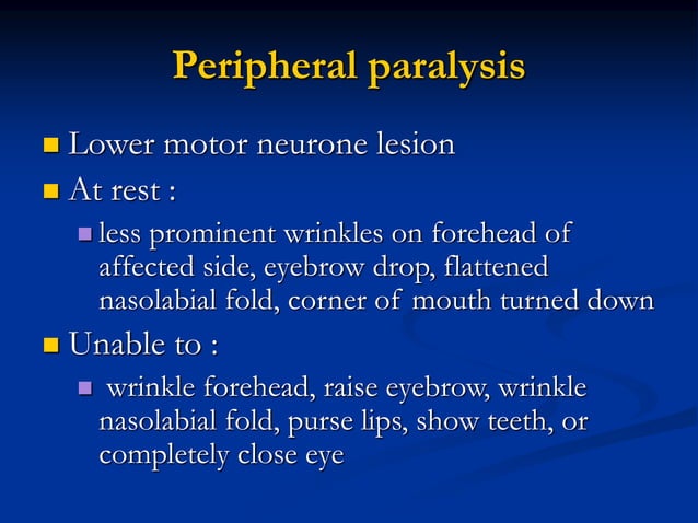 facial nerve paralysis.ppt