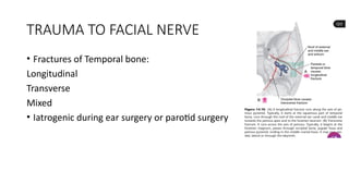 FACIAL NERVE PARALYSIS AND MANAGEMENT-1.pptx