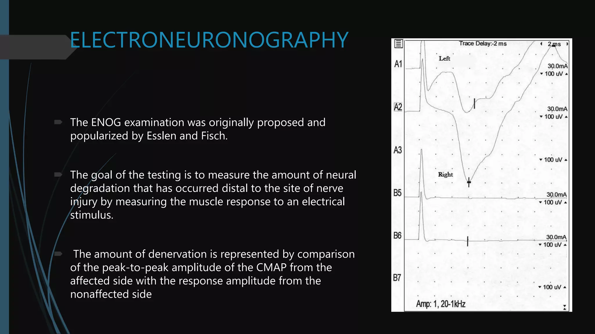 Facial nerve extratemporal | PPTX