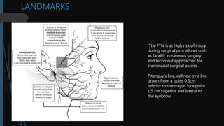 Facial nerve extratemporal | PPTX