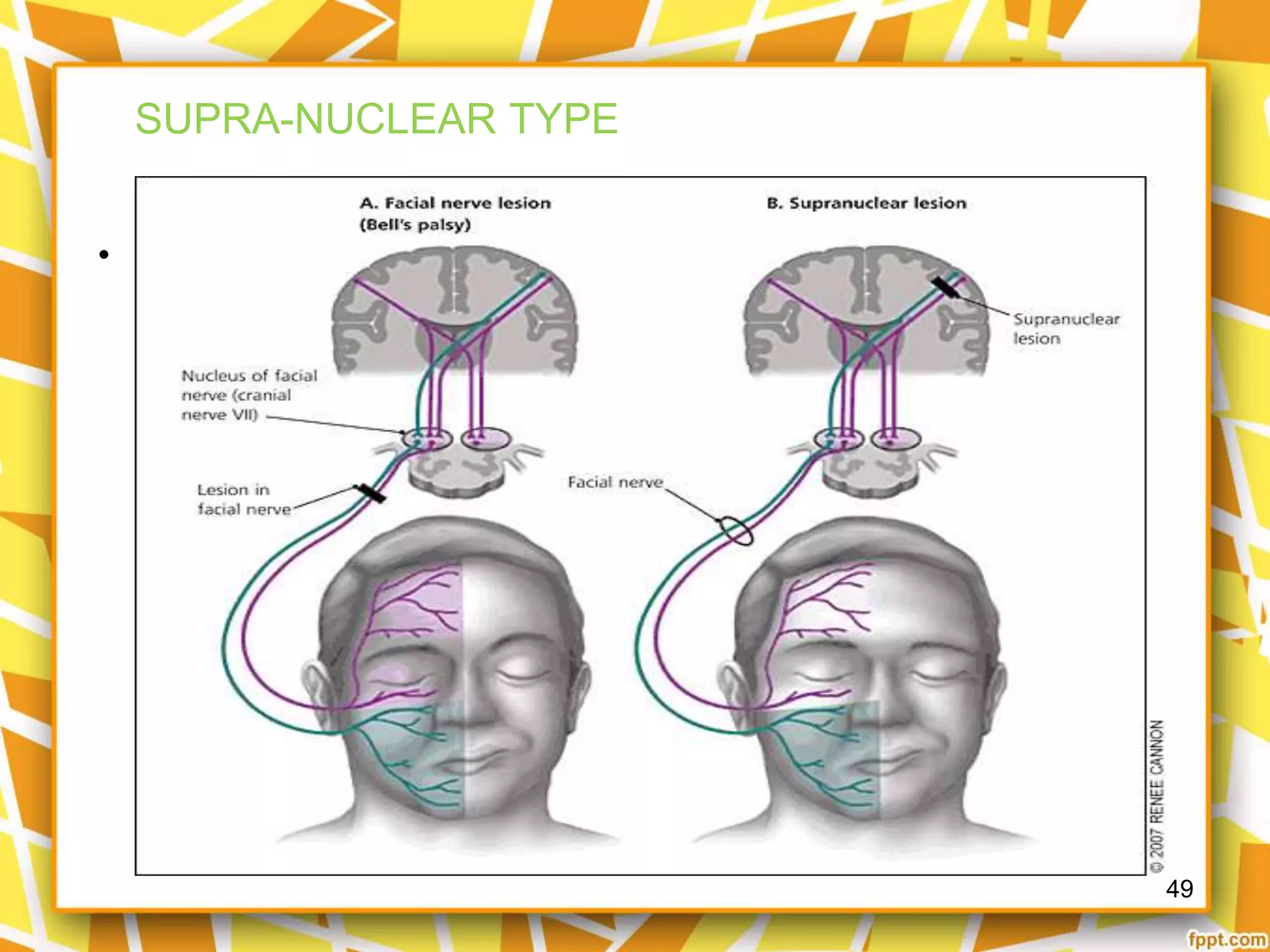 Facial nerve PRESENTATION | PPTX