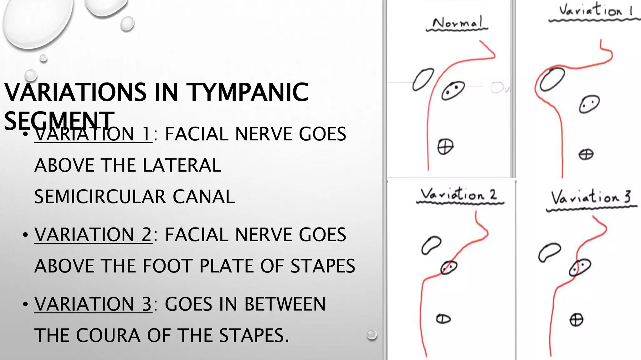 Facial nerve seminar | PPTX