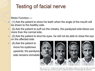 facial nerve seminar.pptx