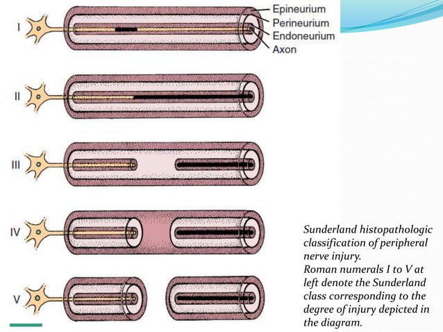 Facial nerve tests | PPTX | Ear, Nose and Throat Conditions | Diseases ...