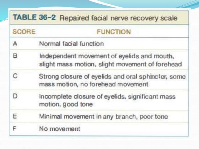 Facial nerve tests | PPTX | Ear, Nose and Throat Conditions | Diseases ...