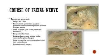 facial nerve Anatomy and leison and investigationspptx | PPTX