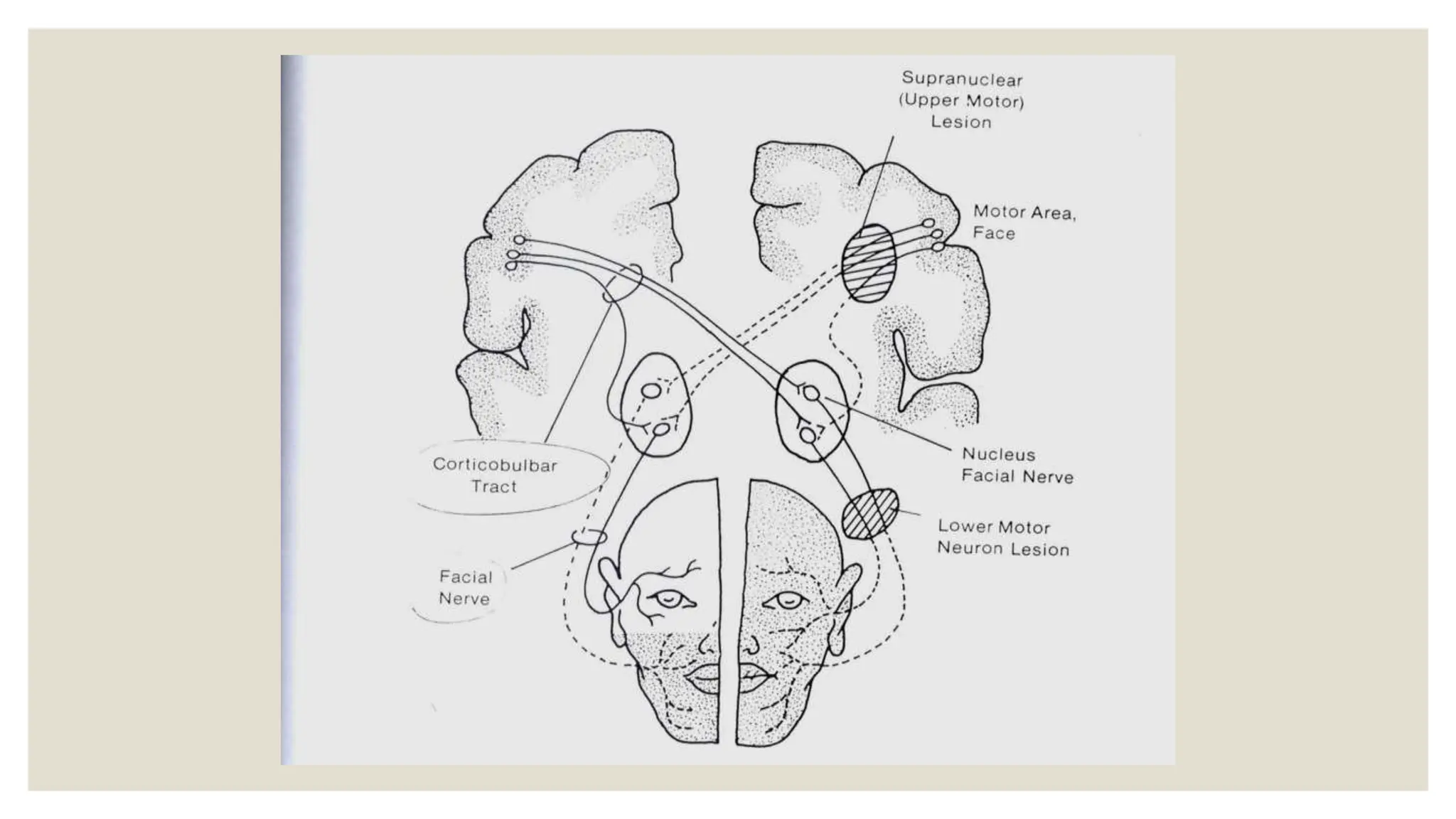 7TH CRANIAL NERVE ANATOMY COURSE AND FUNCTIONS | PPTX