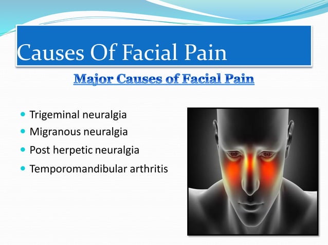 Facial pain | PPT