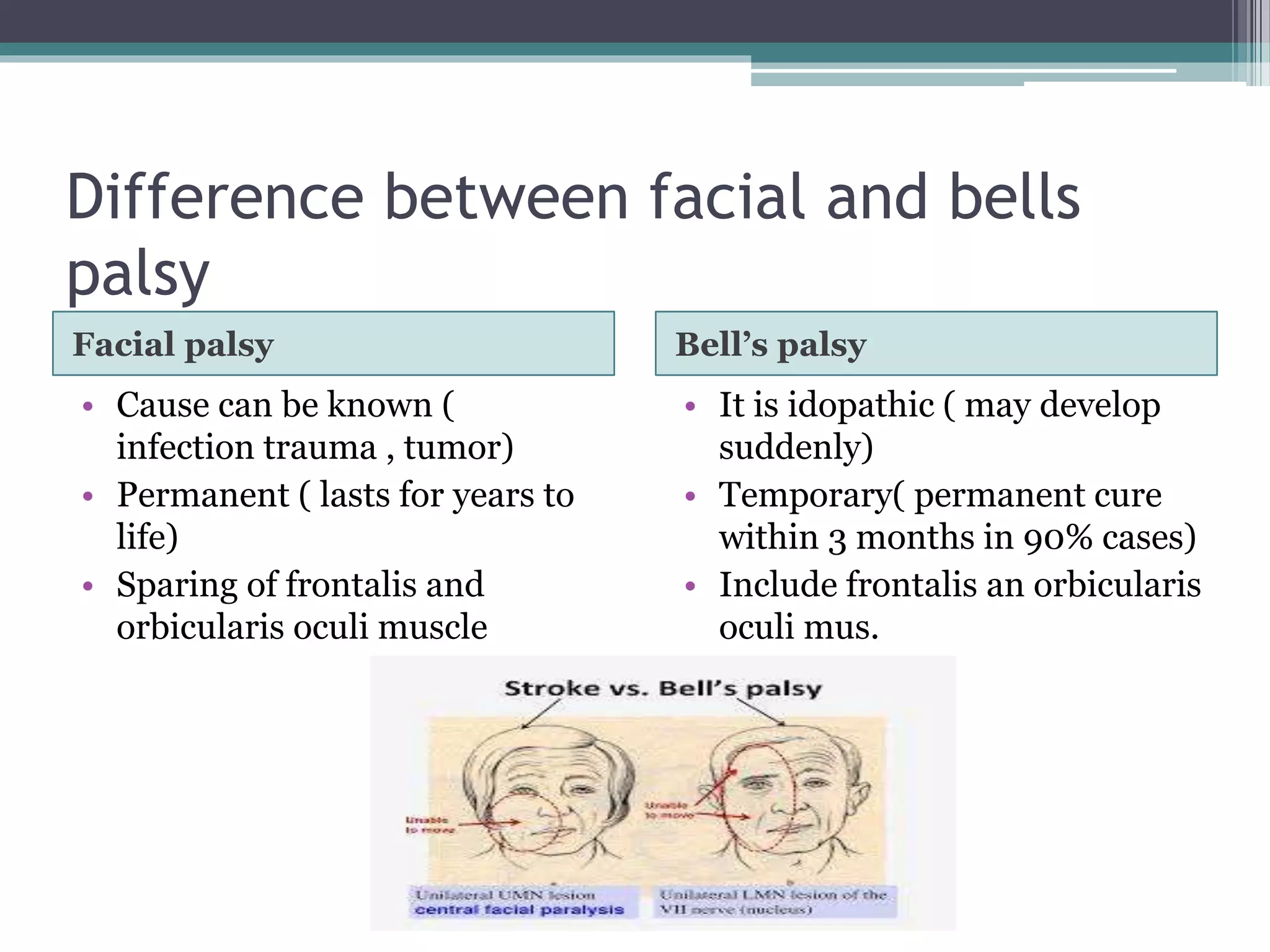 Facial palsy | PPTX