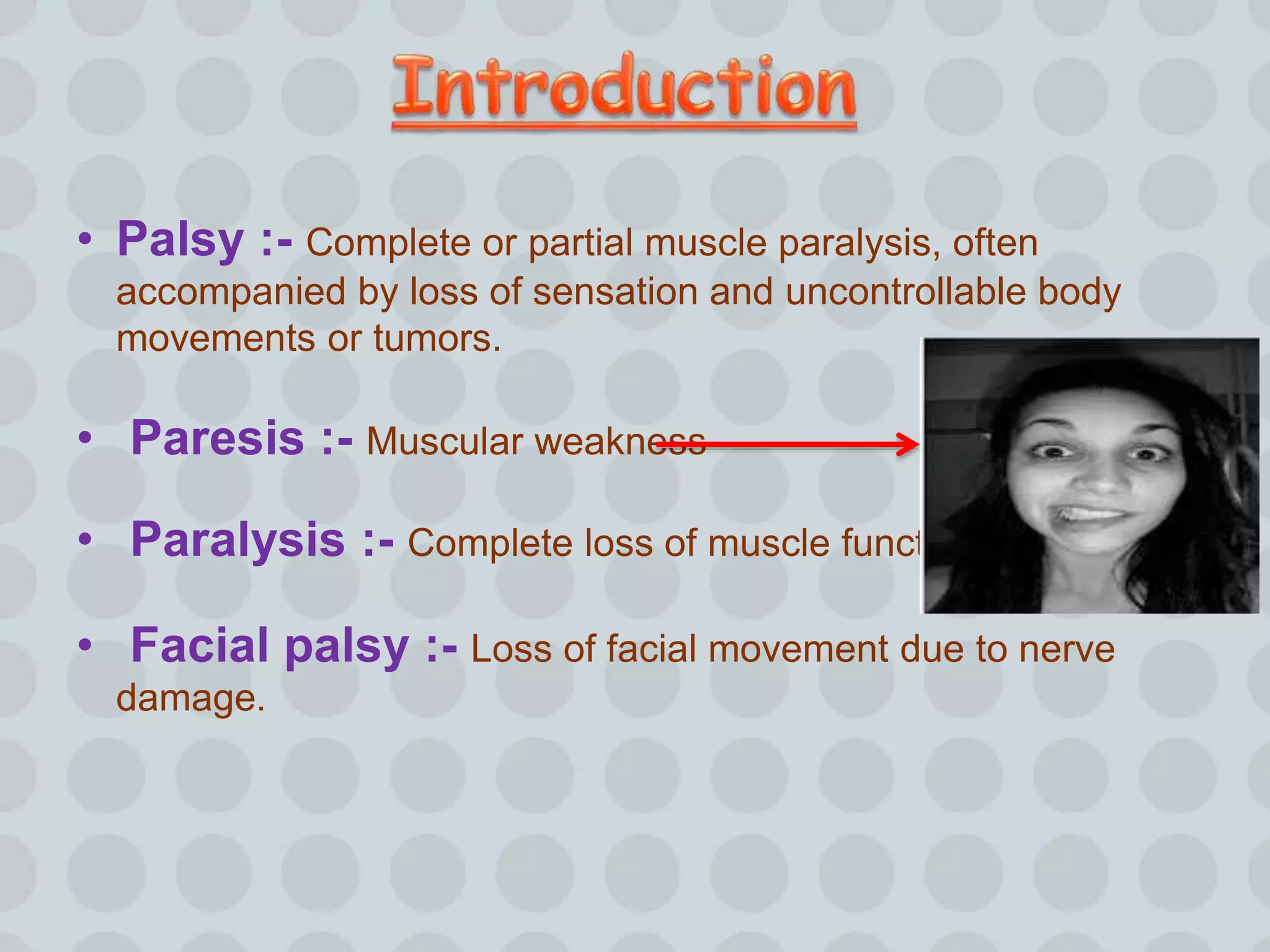 Facial palsy | PPTX