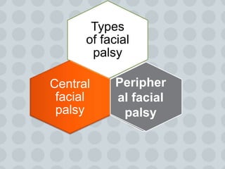 Facial palsy | PPTX