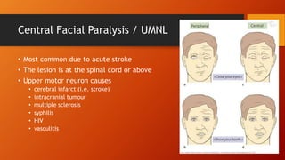 Facial paralysis | PPT