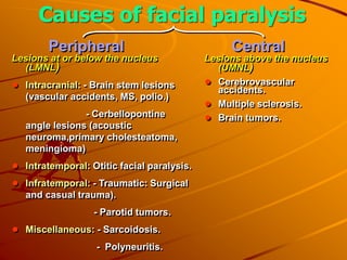 Facial paralysis | PPT