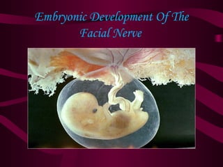 facial nerve paralysis (bell's palsy).ppt