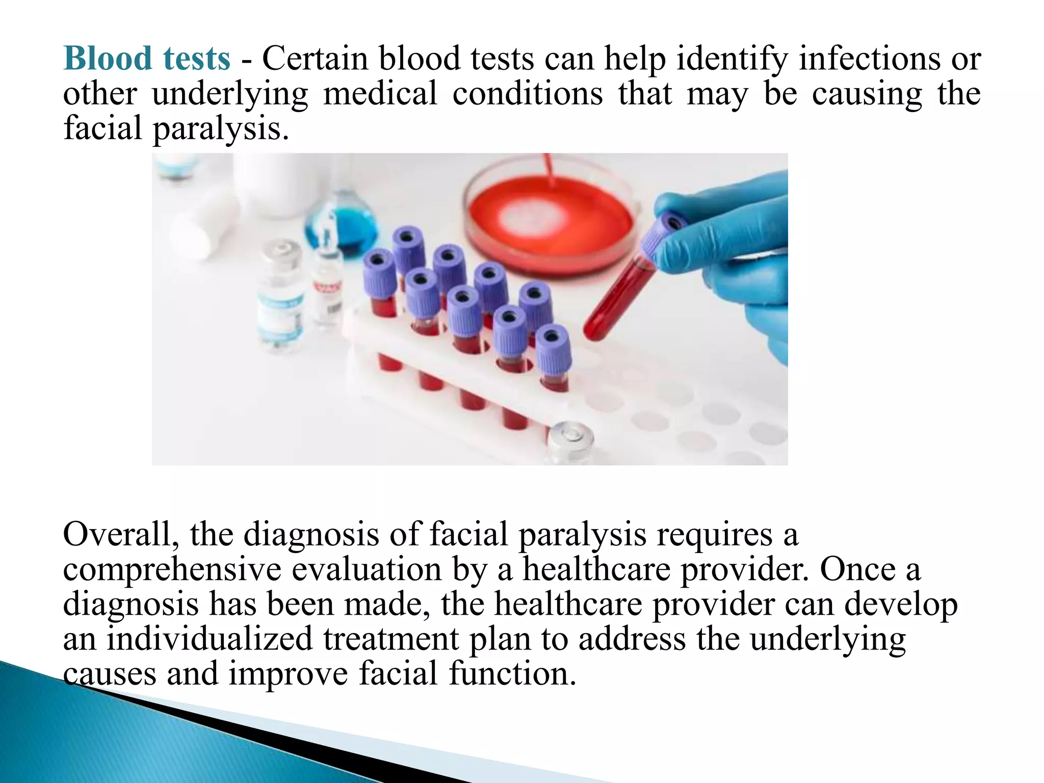Facial Paralysis PPT.pptx